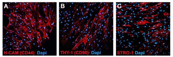 Human Mesenchymal Stem Cells (Bone Marrow) | SCC034